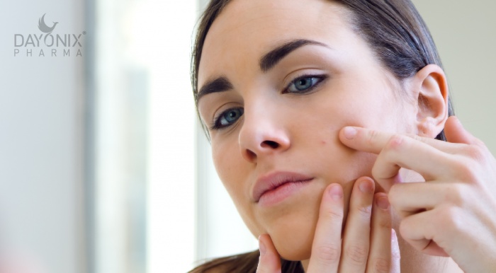 What Is Compulsive Skin Picking? Supplements to Live Happily… - Dayonix ...